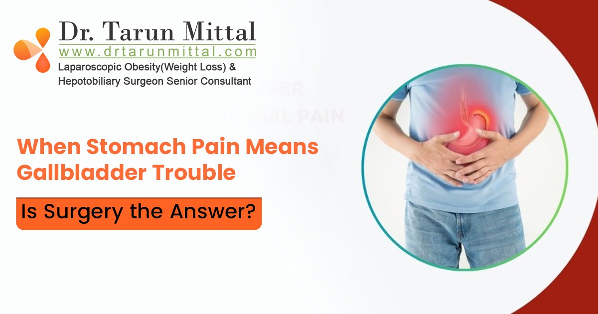 When Stomach Pain Means Gallbladder Trouble: Is Surgery the Answer?